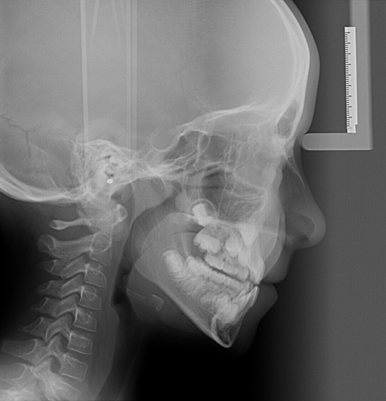 Scanedent - Cefalometrías